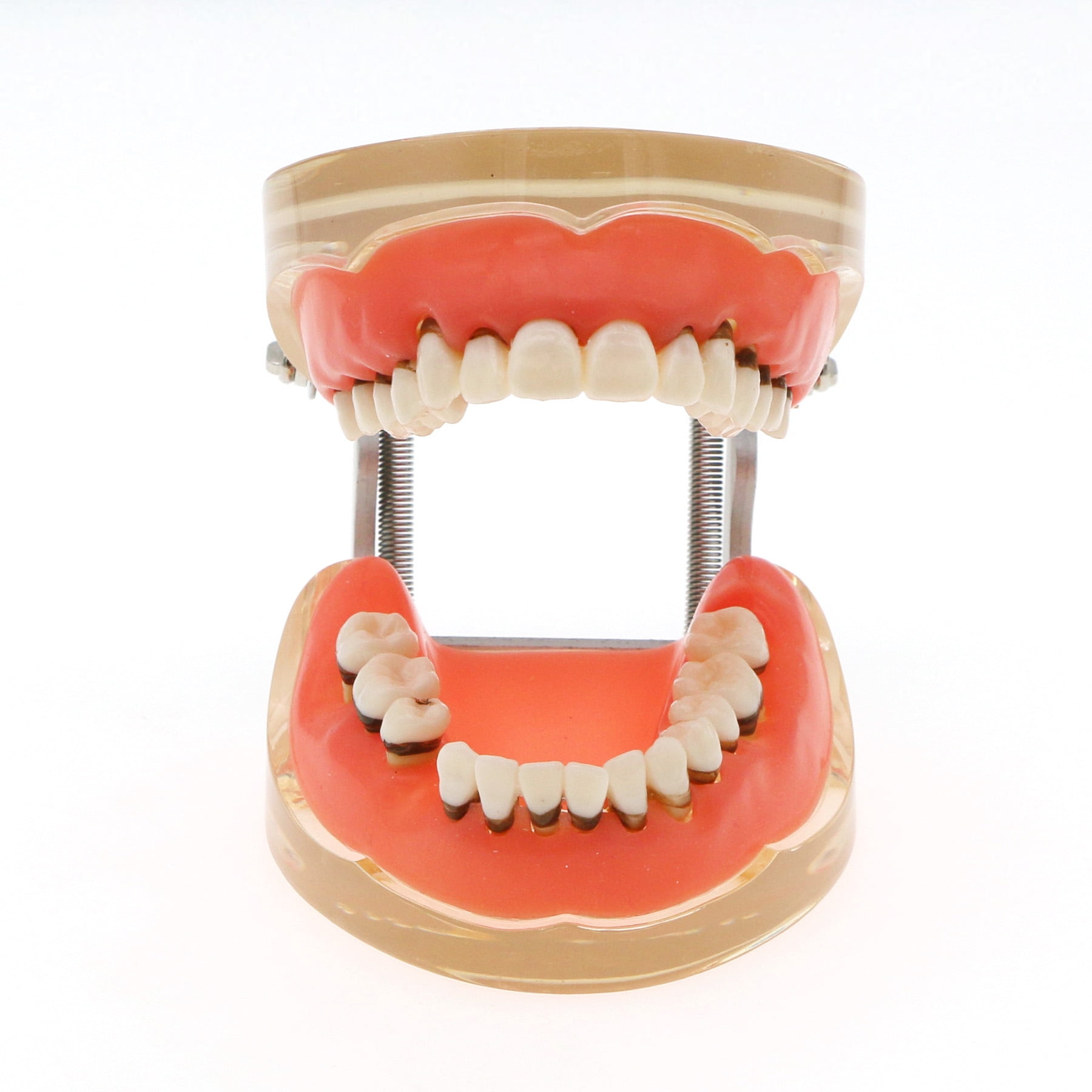 Dental Pathological Typodont Teeth Model Periodontics Implant ...