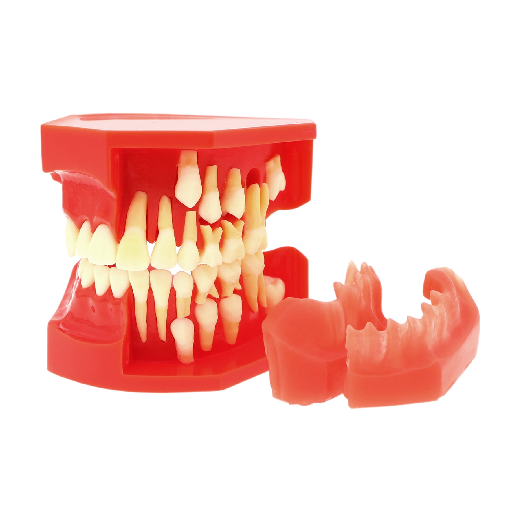 Dental Pathological Typodont Teeth Model Periodontics Implant ...